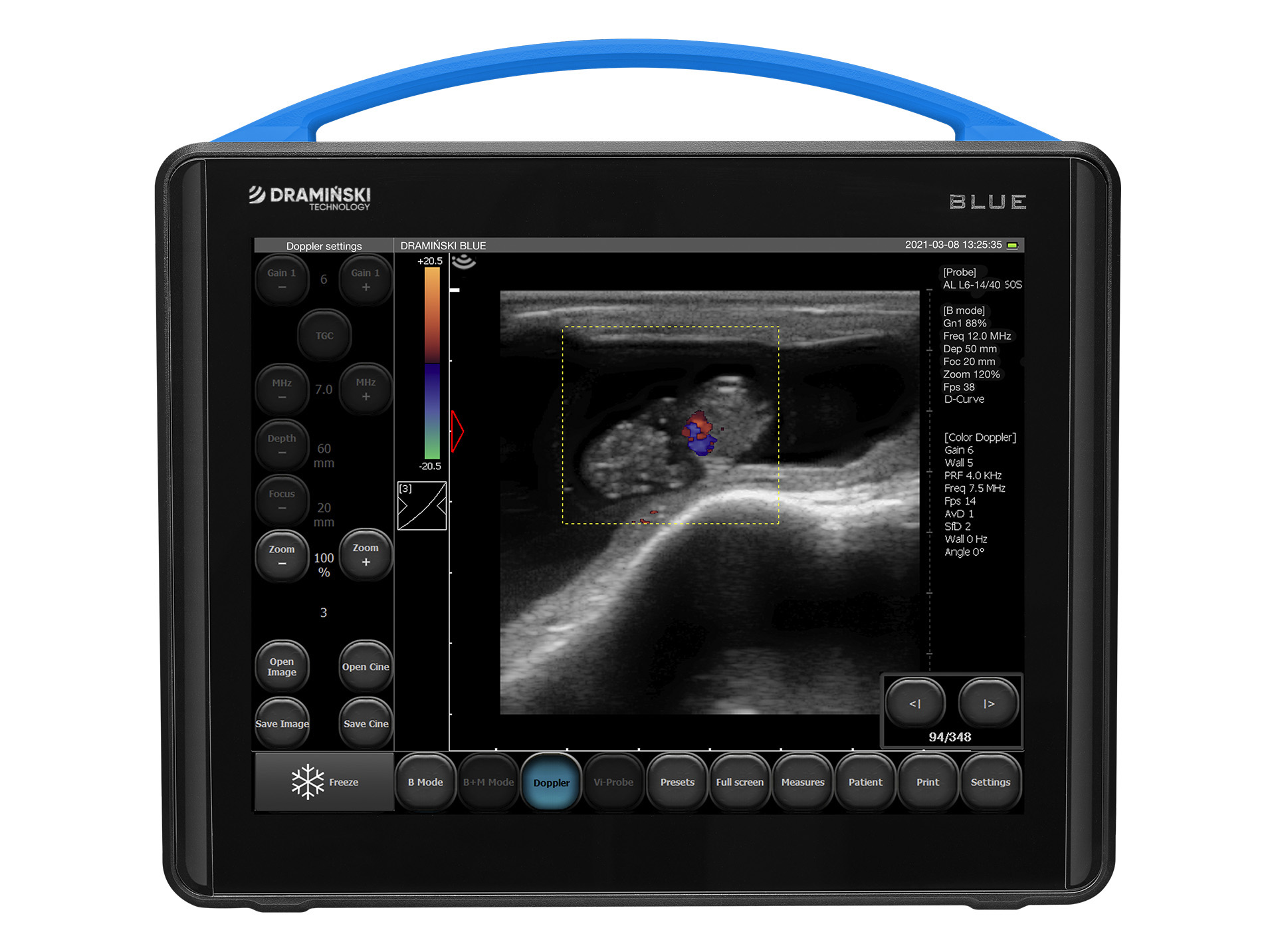 BLUE ultrasound scanner - Dramiński