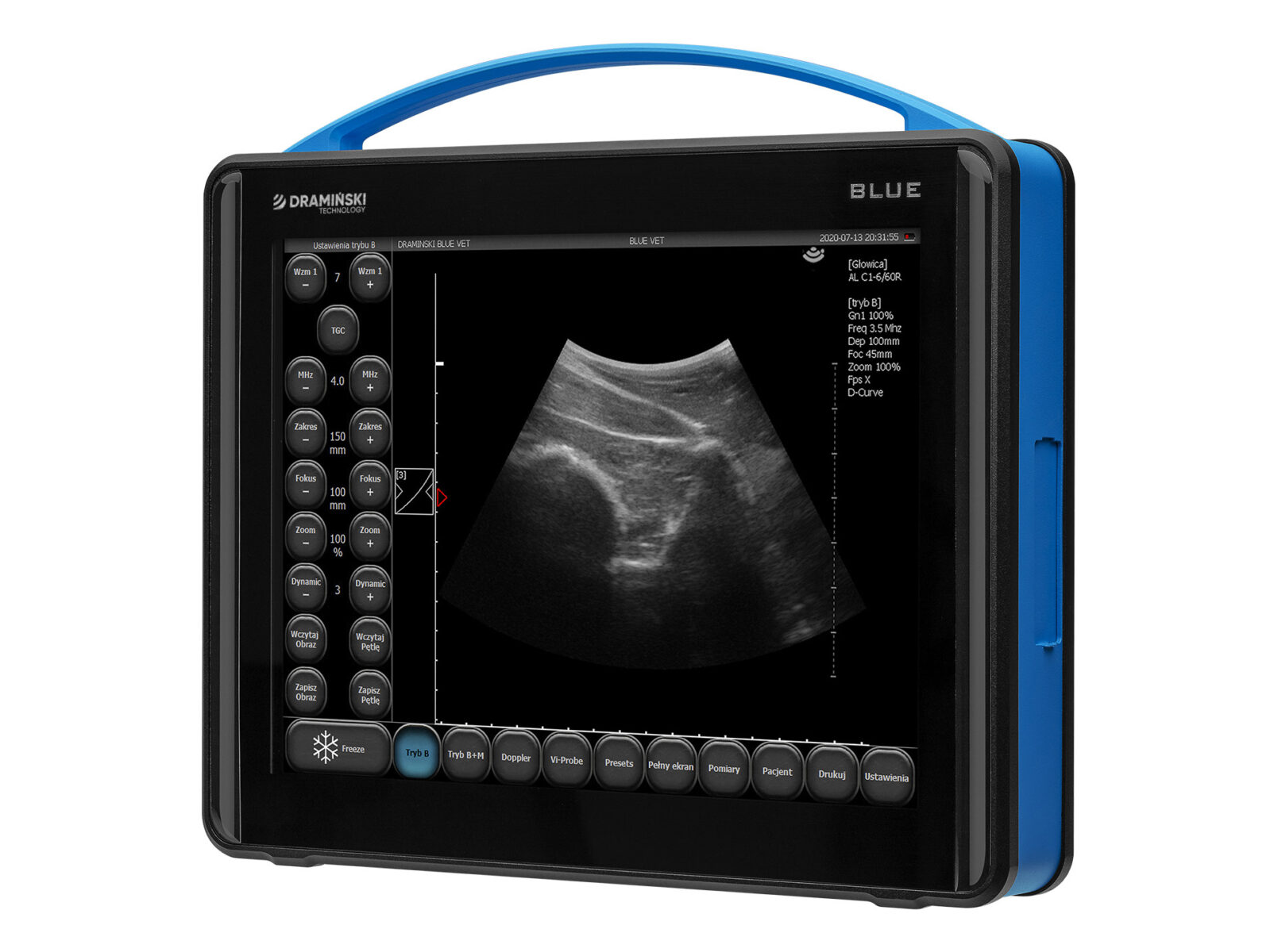 BLUE ultrasound scanner - Dramiński