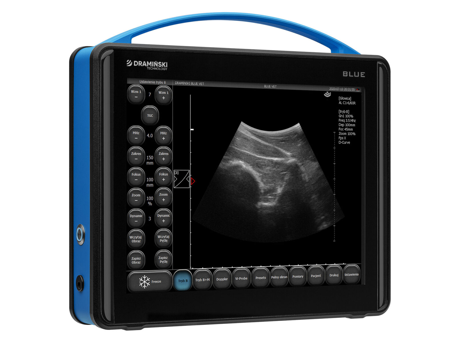 BLUE ultrasound scanner - Dramiński