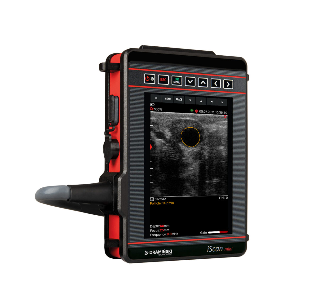 iScan mini ultrasound scanner - Dramiński
