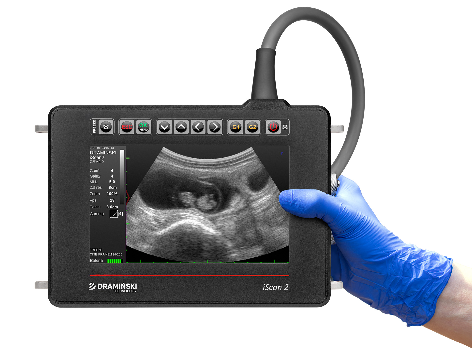 iScan 2 ultrasound scanner - Dramiński