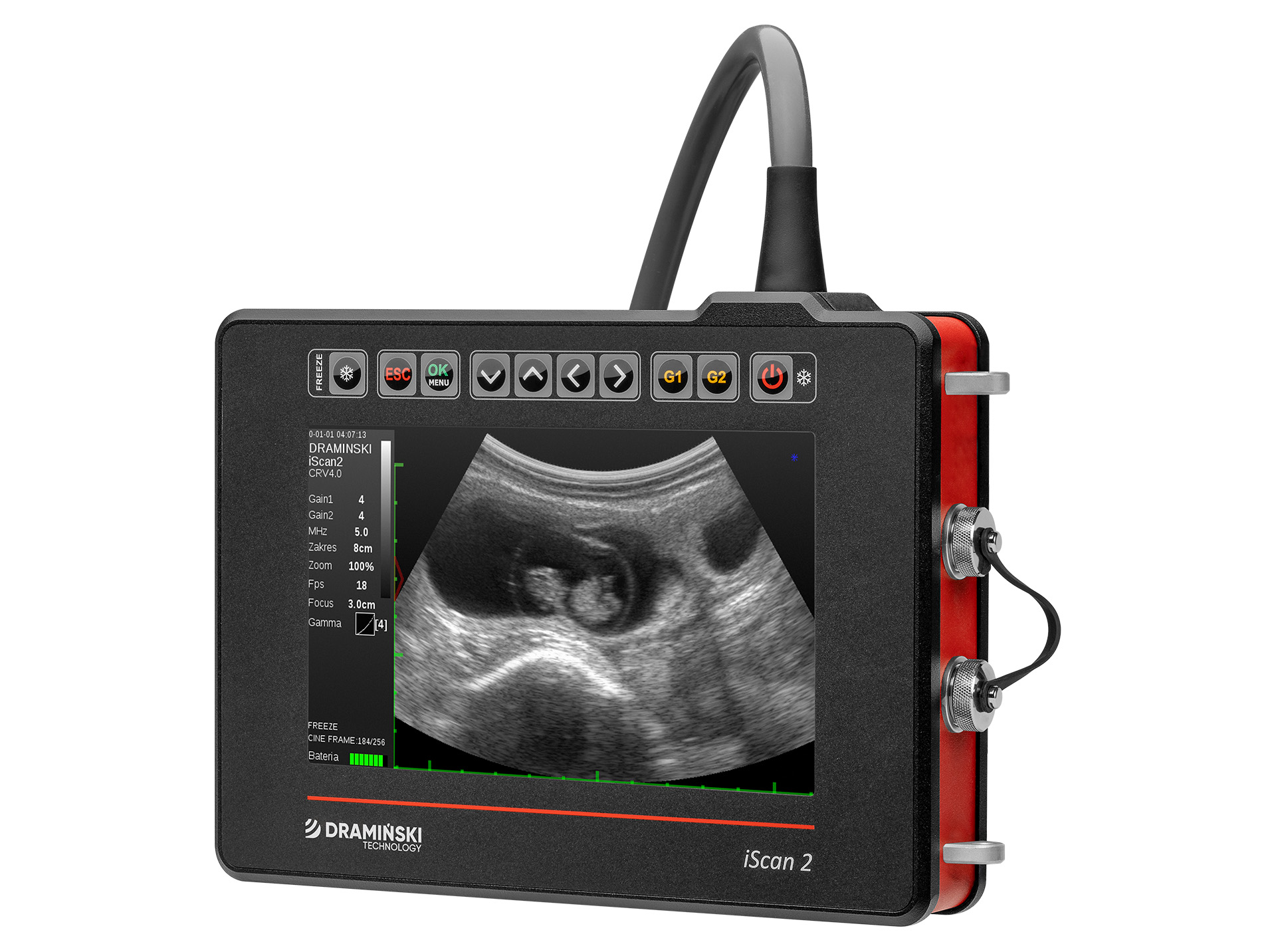 iScan 2 ultrasound scanner - Dramiński
