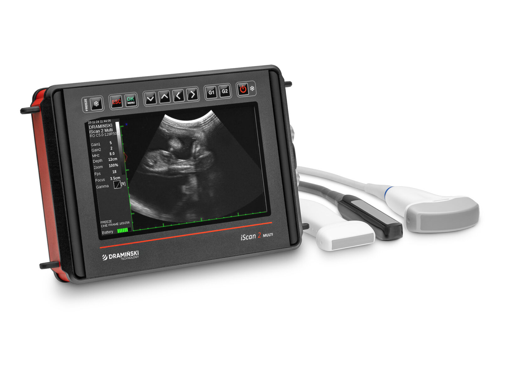 iScan 2 MULTI ultrasound scanner - Dramiński