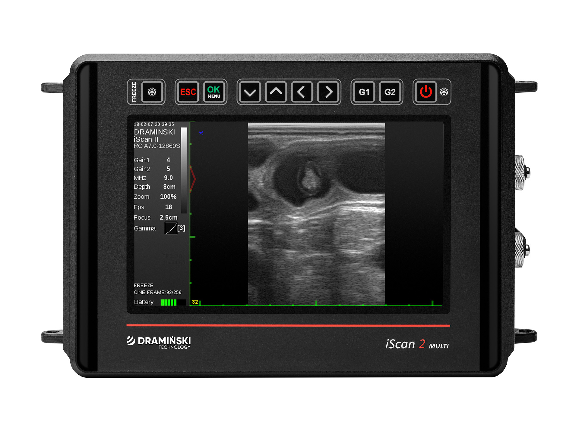 iScan 2 MULTI ultrasound scanner - Dramiński