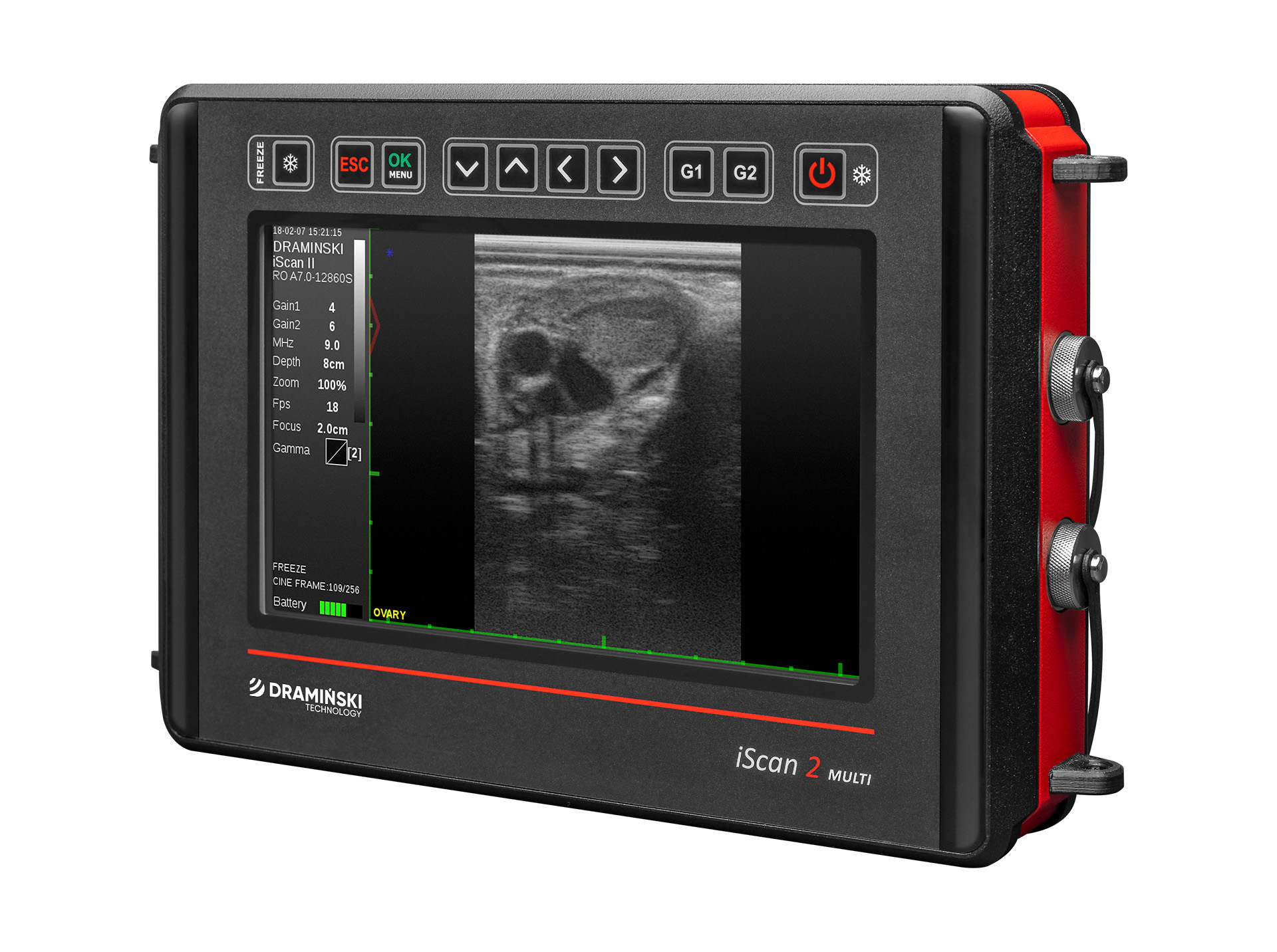 iScan 2 MULTI ultrasound scanner - Dramiński