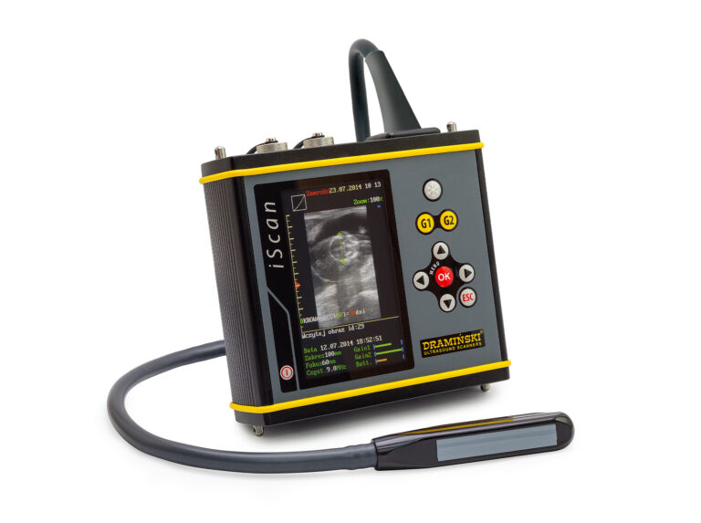 iScan ultrasound scanner - Dramiński