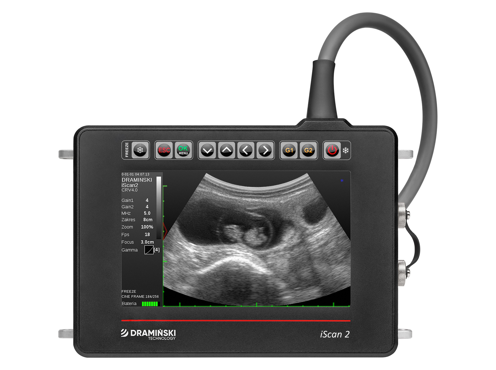 iScan 2 ultrasound scanner - Dramiński