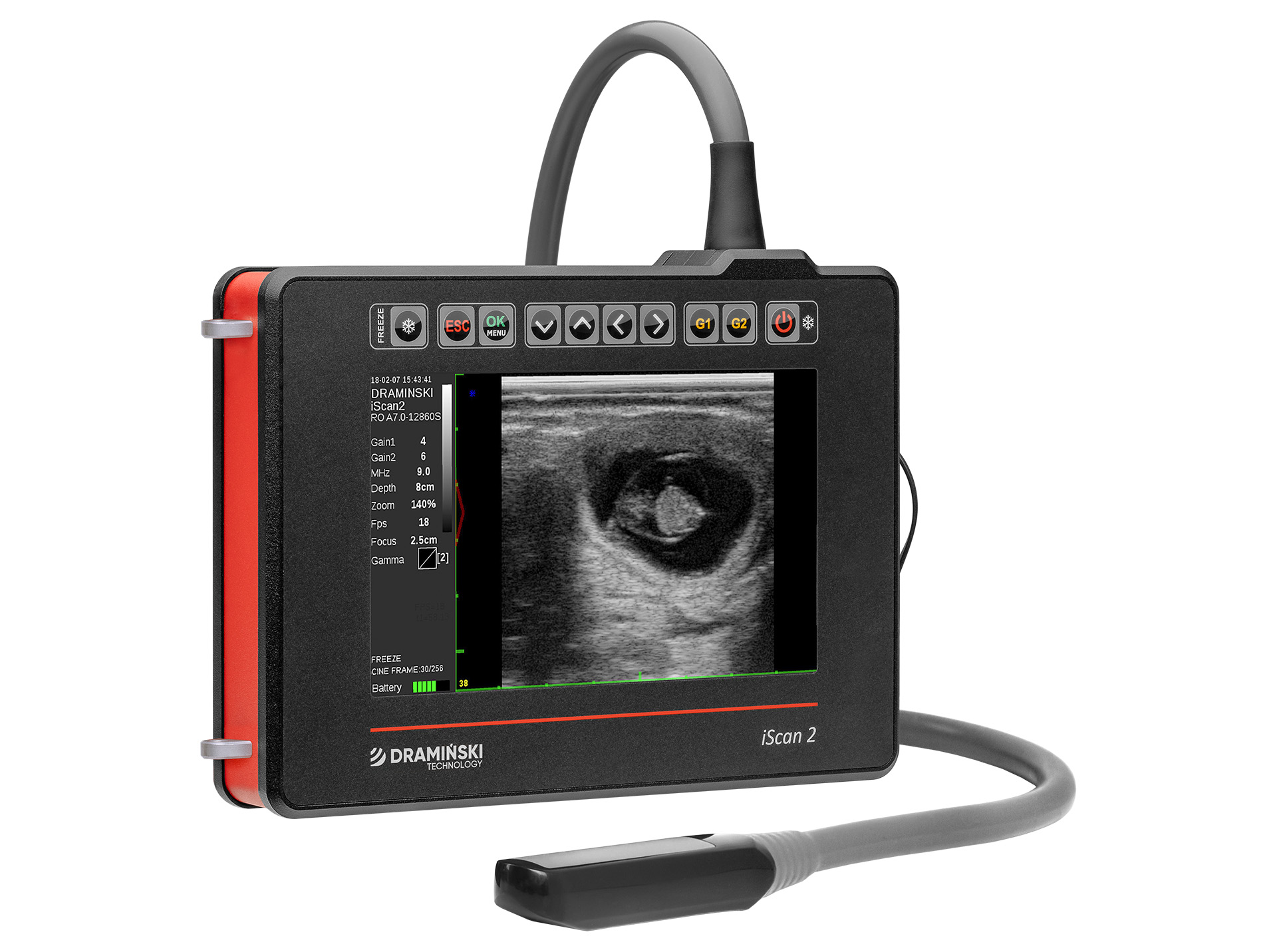 iScan 2 ultrasound scanner - Dramiński