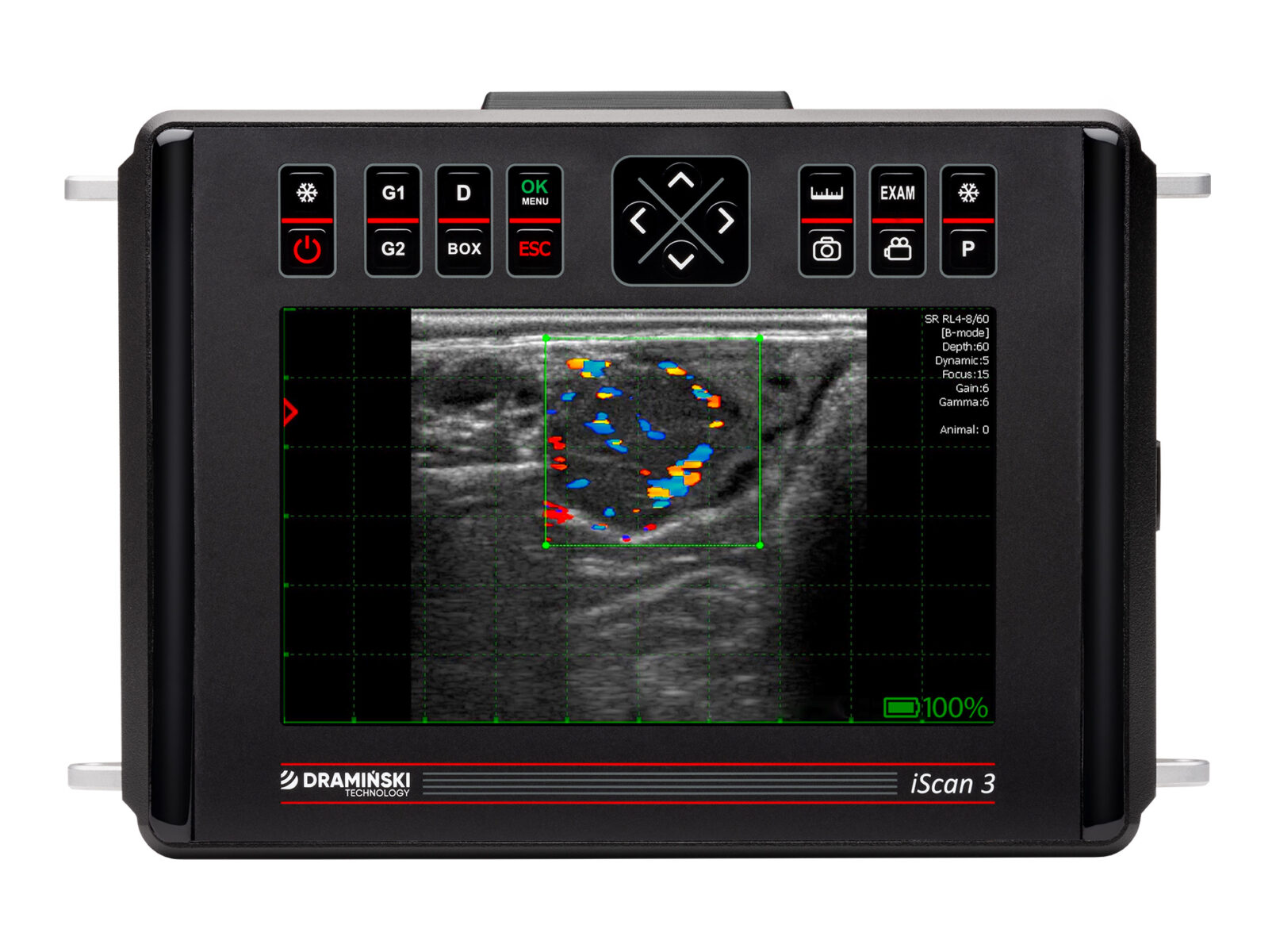 iScan 3 ultrasound scanner - Dramiński