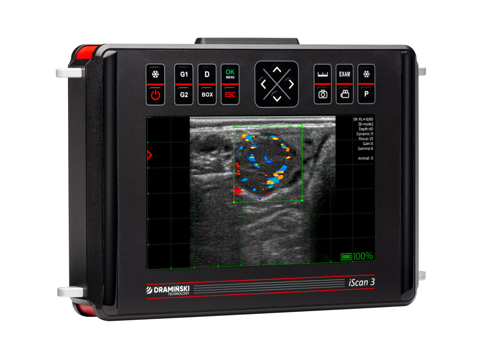 iScan 3 ultrasound scanner - Dramiński