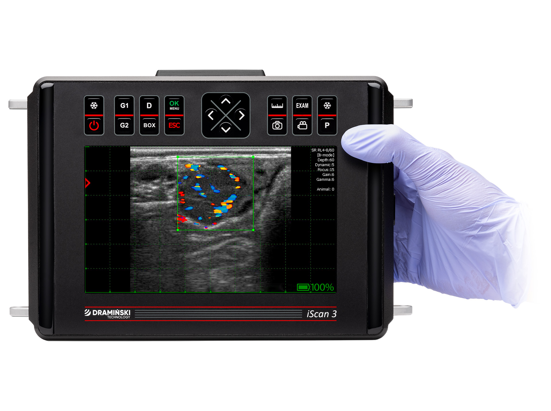 iScan 3 ultrasound scanner - Dramiński