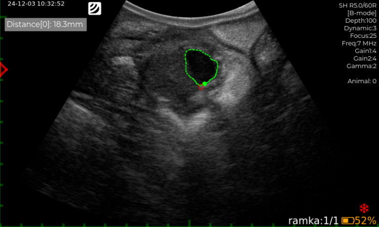 iScan 3 ultrasound scanner - Dramiński