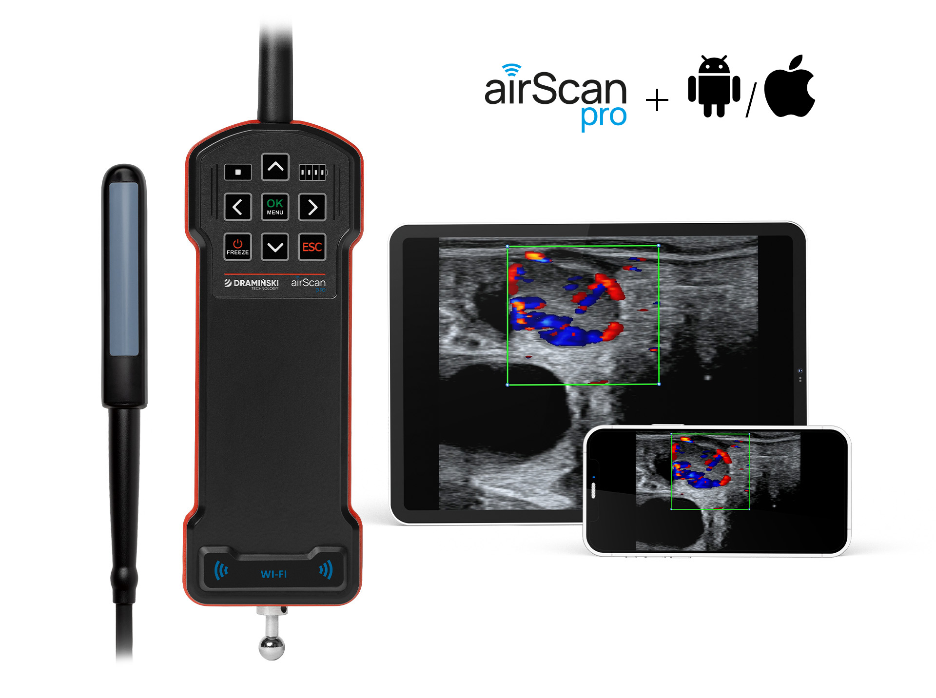 airScan pro wireless ultrasound scanner - Dramiński
