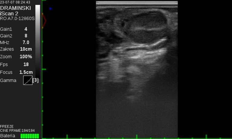 The cow’s normal reproductive cycle and ovarian anatomy - Dramiński