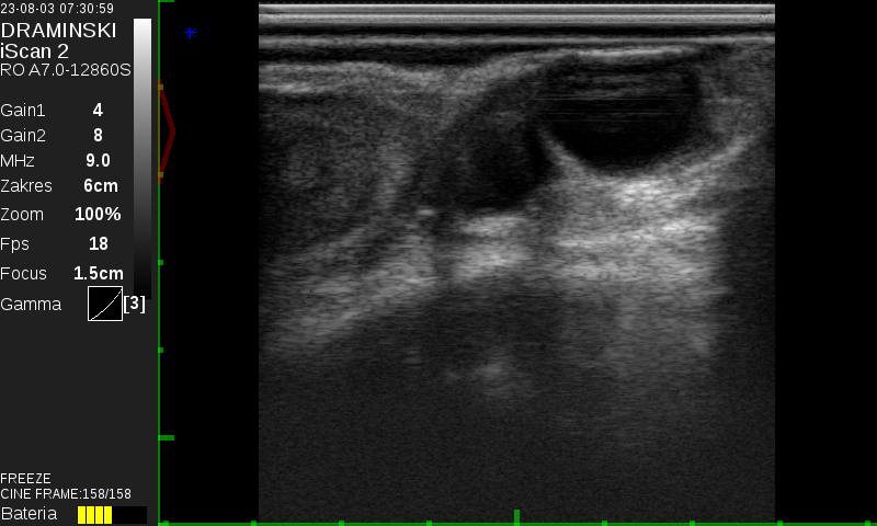 The cow’s normal reproductive cycle and ovarian anatomy - Dramiński